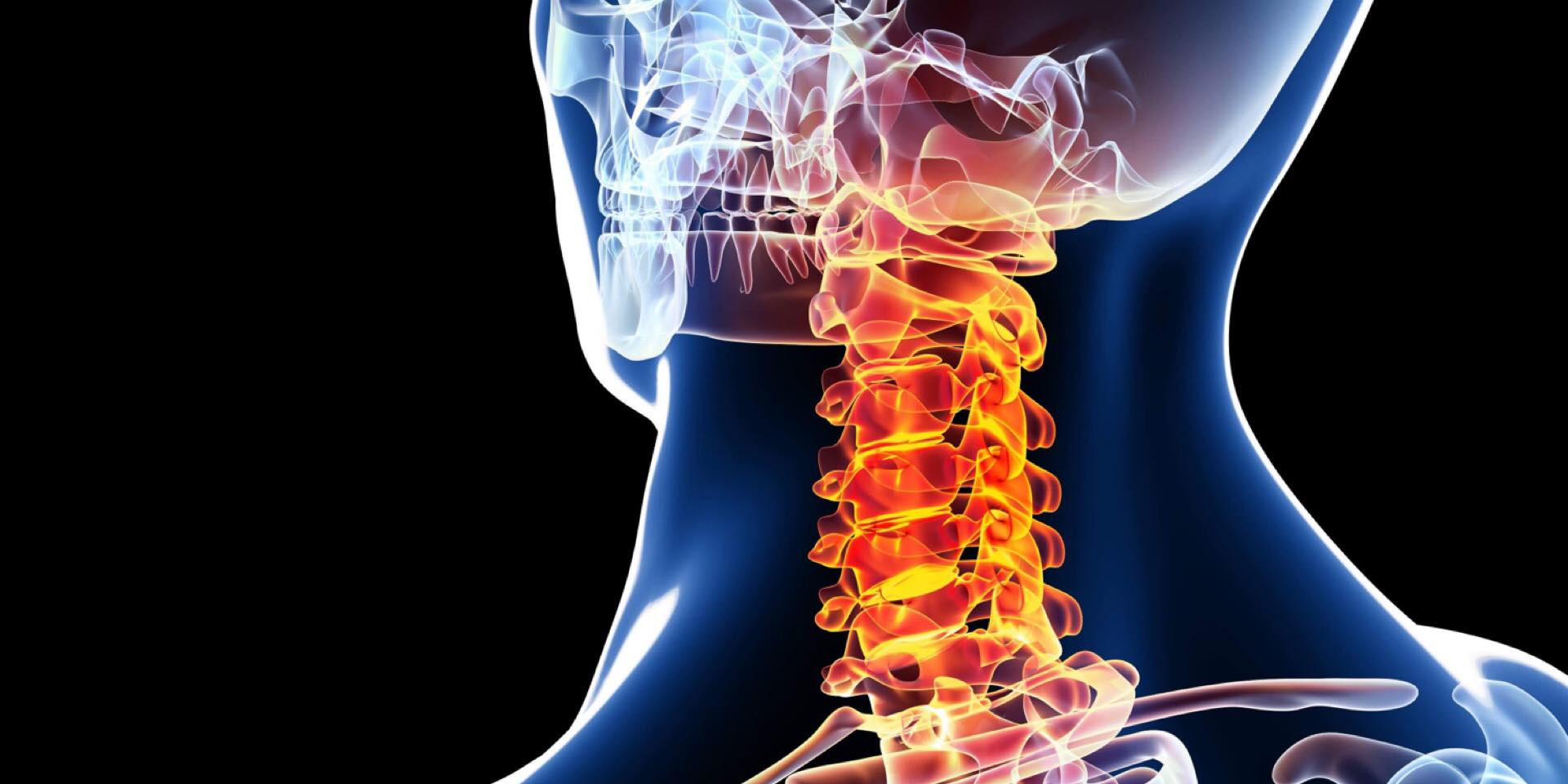 Neck Pain Therapy & Treatment | Pain Relief Institute